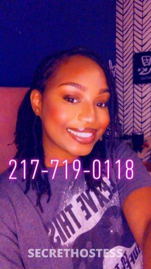 2177190118 Remy South City INCALLS: Escort - 30